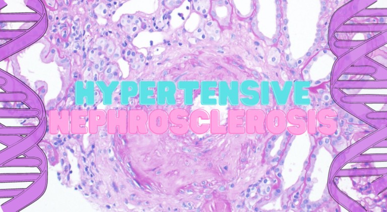 Hypertensive Nephropathy: A Silent Threat to Your Kidney Health