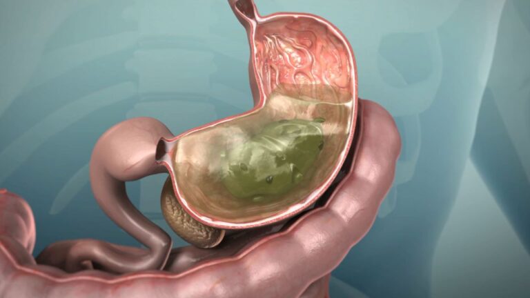 GI Water and Electrolyte Absorption: A Comprehensive Guide - Pathway ...